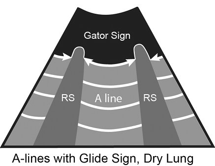 FASTVet Free Resource: Blog Preview - Chest Tube Site TFAST® Findings ...