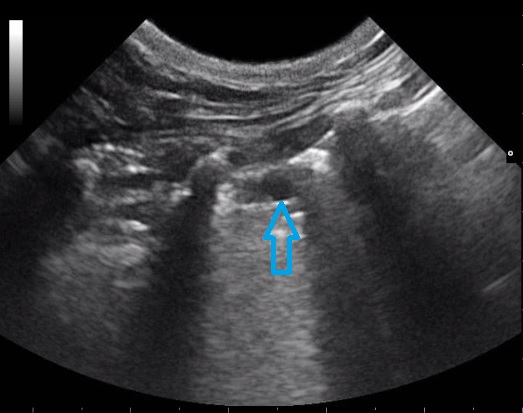 Case Study: Using the Vet BLUE® and Its Sensitivity Exceeding Thoracic ...