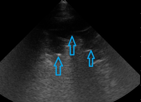 FASTVet Free Resource: Blog Preview - Case study: Using the Vet BLUE ...