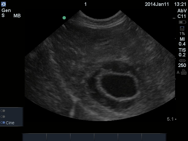 FASTVet Free Resources: Blog Preview - The Gallbladder Halo Sign - FASTVet