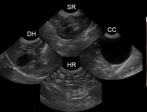 Learn Global FAST Ultrasound In-Person with Our Hands On Lab ...