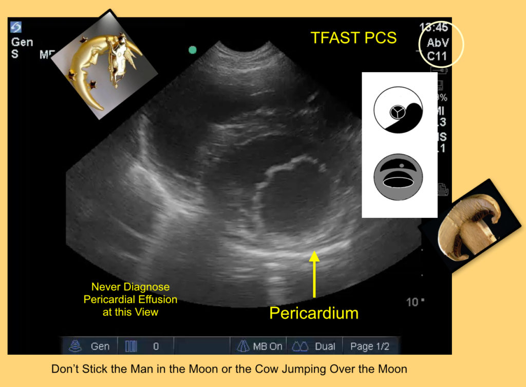 FASTVet Free Resources: ECC Blog - TFAST® Views of the Heart and their ...